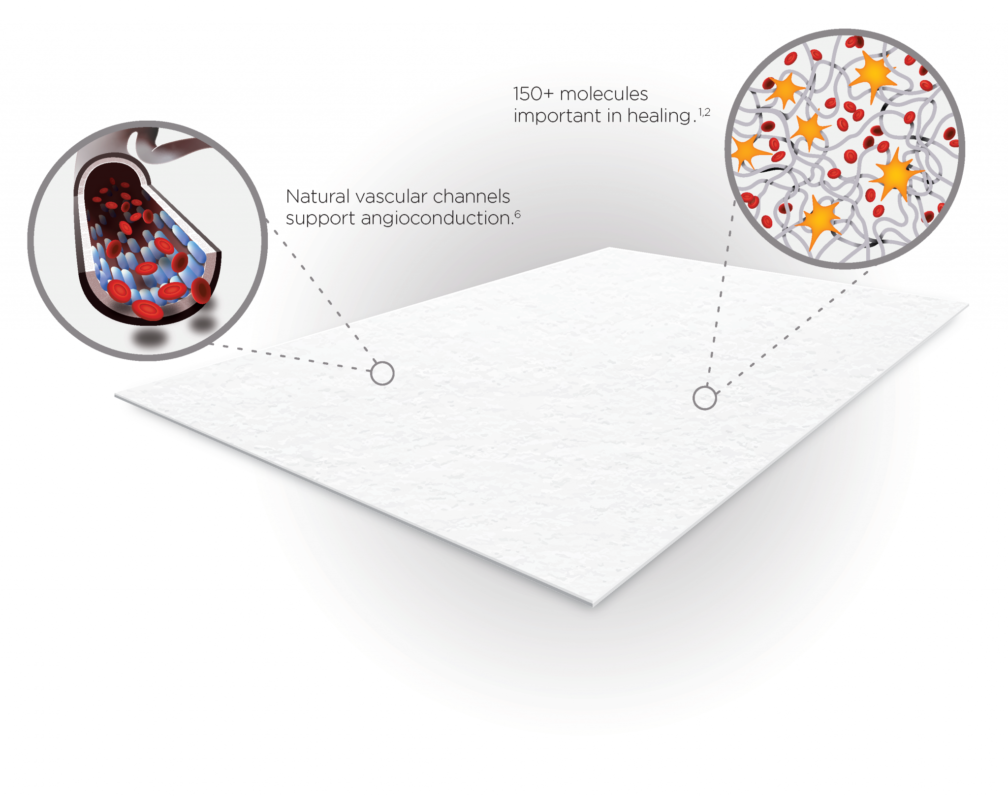 Endoform™ | Aroa Biosurgery