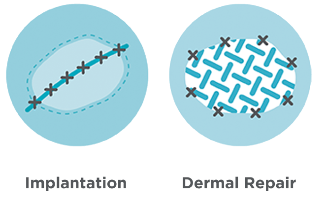 Myriad Matrix™ | AROA