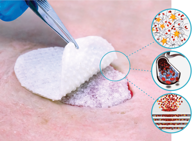 Myriad Morcells™ | AROA