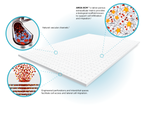 Myriad Matrix™ | AROA