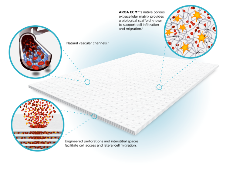 Myriad Matrix™ | AROA