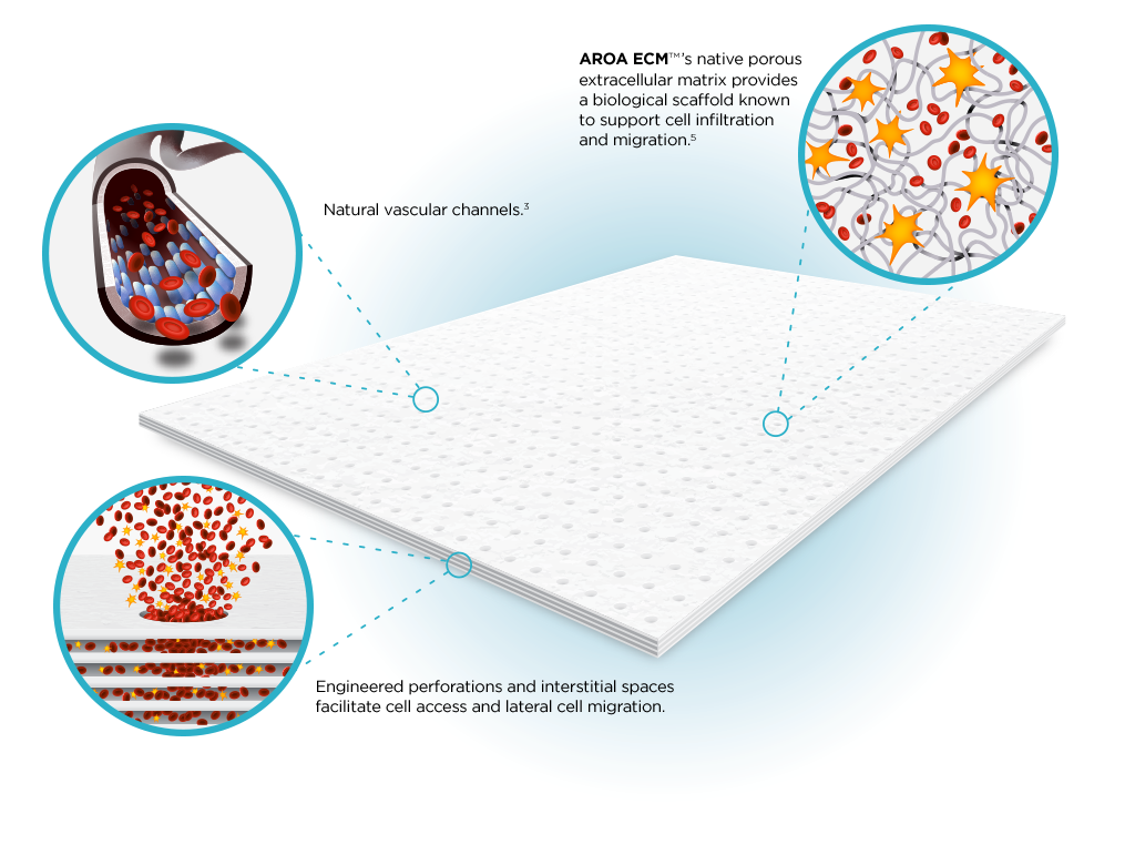Myriad Matrix™ | AROA
