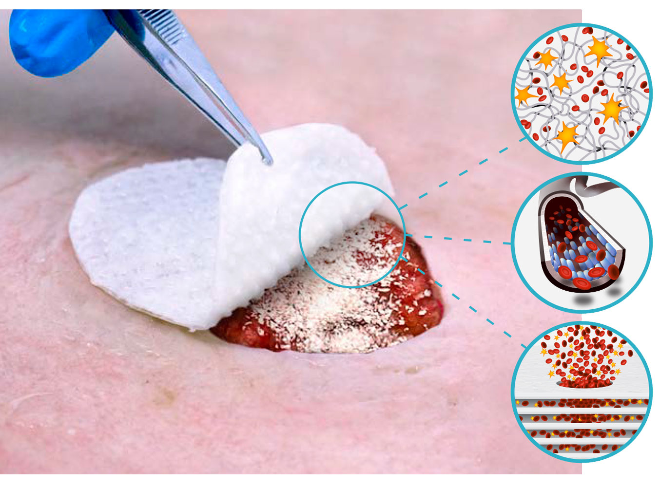 Myriad Morcells Fine™ | AROA