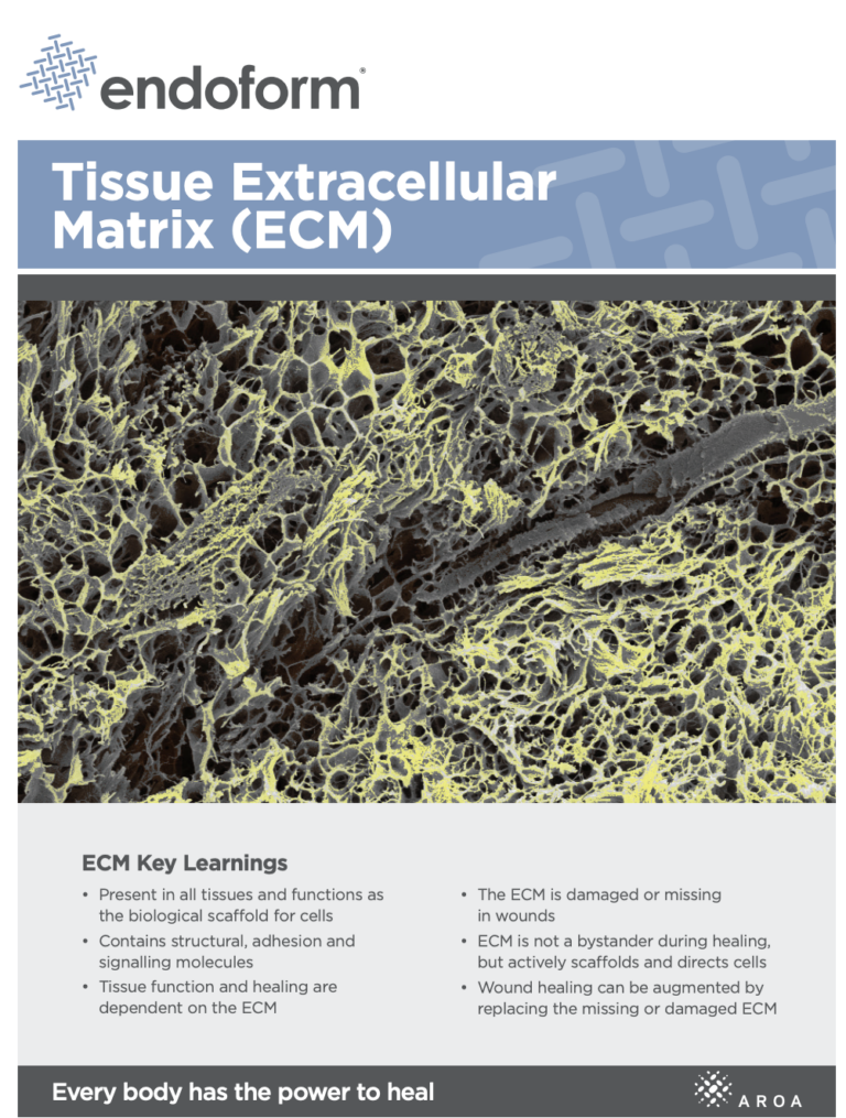 Tissue Extracellular Matrix (ECM) Brochure | AROA