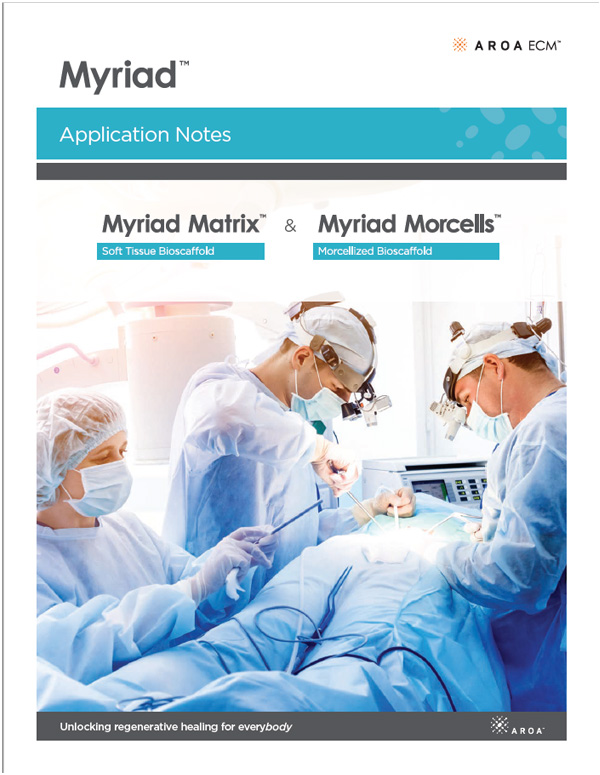 Myriad Matrix™ | AROA